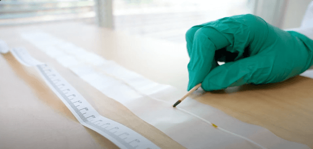 Monitor EoE with EnteroTracker® | EnteroTrack